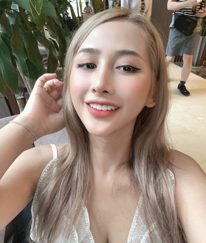 Thu gọn cánh mũi - Minhon Plastic Surgery